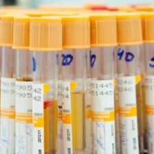 Chelate Heavy Metals Safely and Effectively